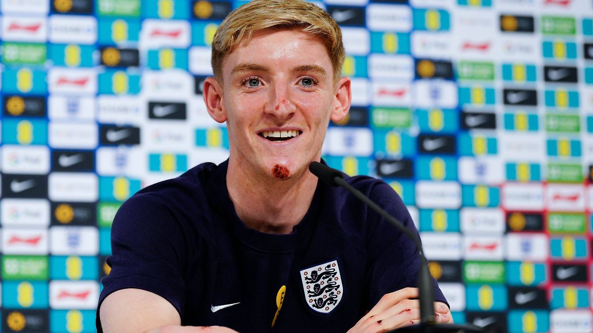 Der Sport-Tag: Sturz vom Rad: England-Profi im Gesicht gezeichnet - ntv.de