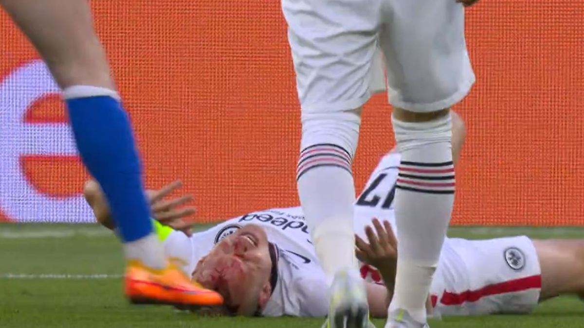 Fünf Minuten im Finale gespielt: Frankfurt-Kapitän Rode blutet stark am ...