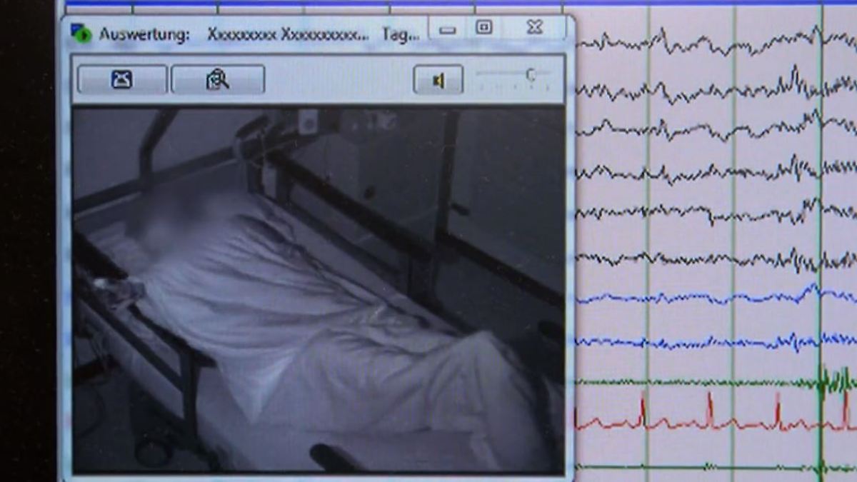 Können Jahrzehnte zuvor auftreten: Studie identifiziert frühe ...