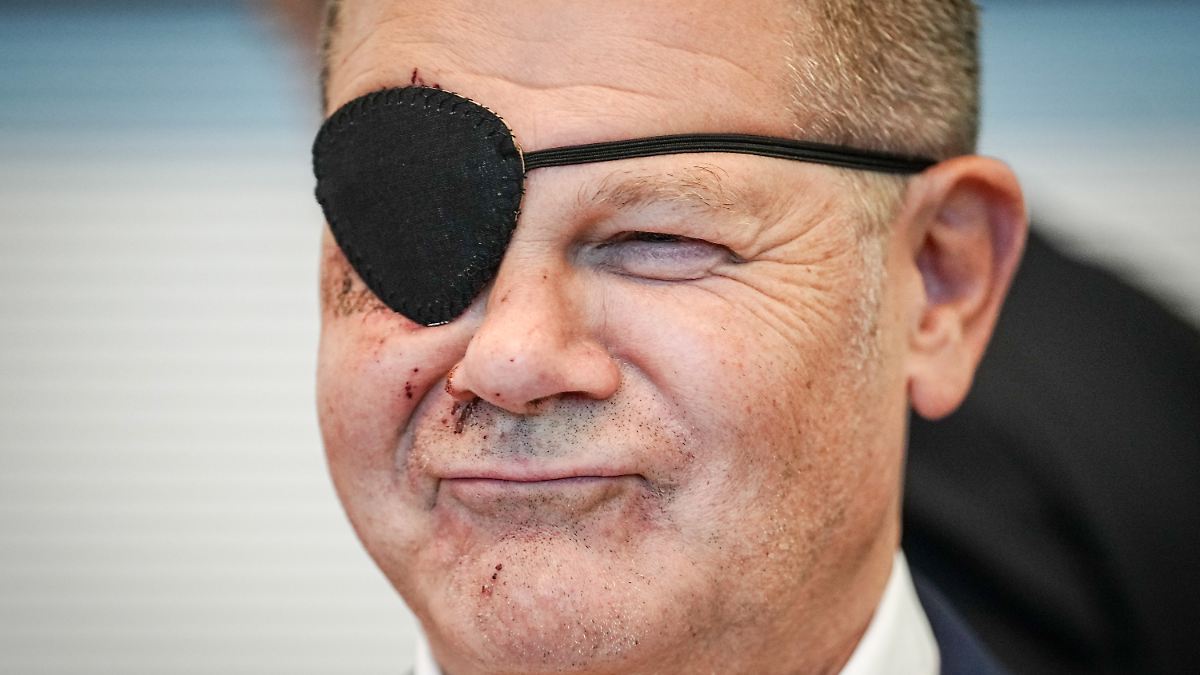 "Wer den Schaden hat ...": Scholz' Augenklappenfoto tritt Meme-Welle im ...
