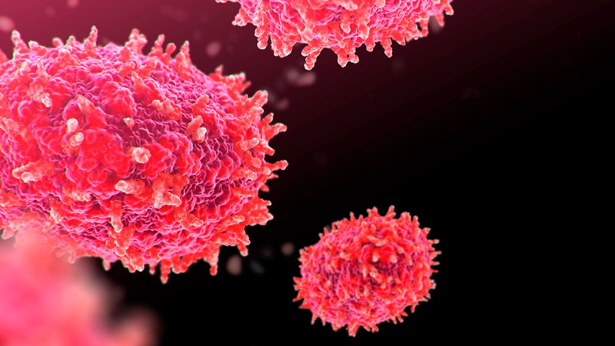 WHO: Weltweite Überwachung nötig: Ursprung des Mpox-Ausbruchs um Jahre ...