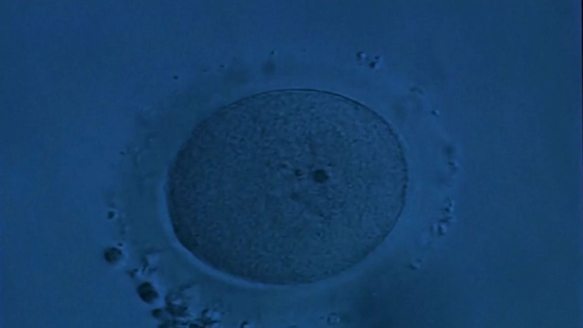 Gleiche Rechte wie Kinder: Embryo-Urteil in Alabama verschreckt In ...